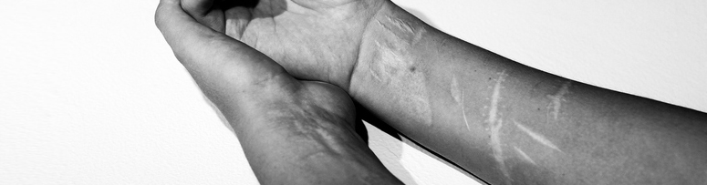 Serious Self-Harm Encouragement Criminalised | Nelson Guest & Partners